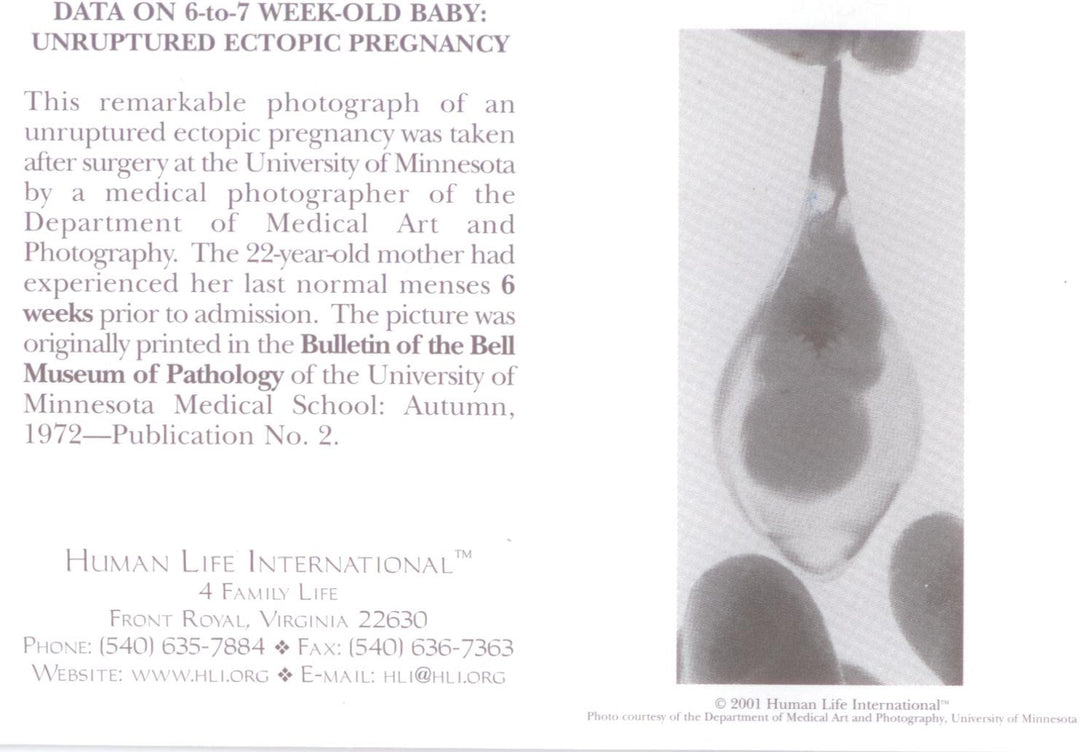 Everyone's Biography – Human Life International